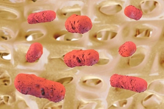 Tout savoir sur la salmonellose : symptômes et prévention - Santé