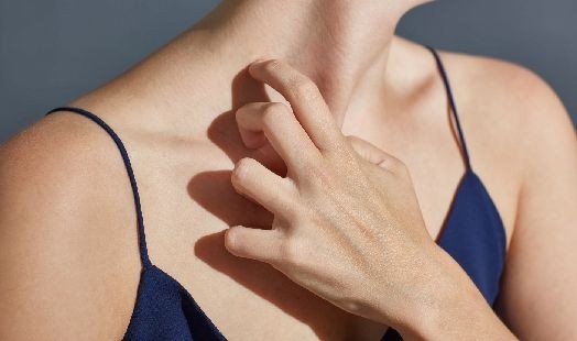 Boutons d’allergie au soleil : comment les traiter dès leur apparition