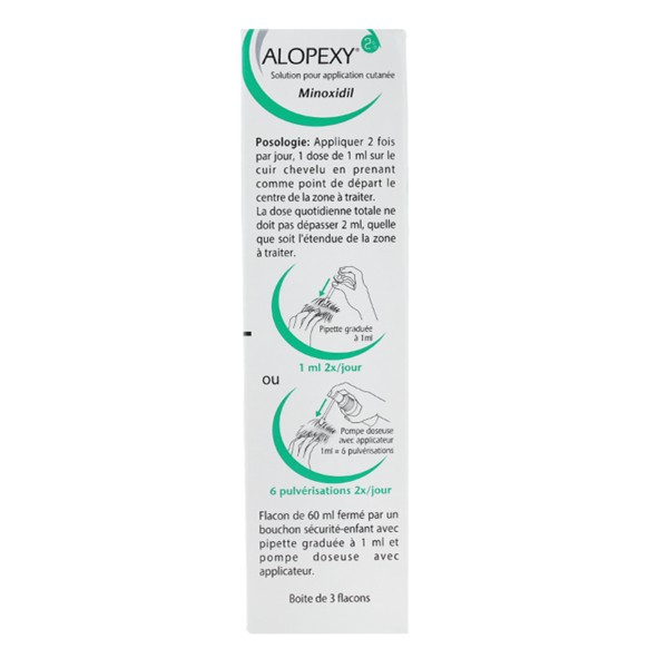 Alopexy Minoxidil 2 % solution chute de cheveux - Alopécie