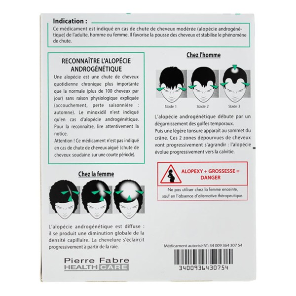 Alopexy Minoxidil 2 % solution chute de cheveux - Alopécie